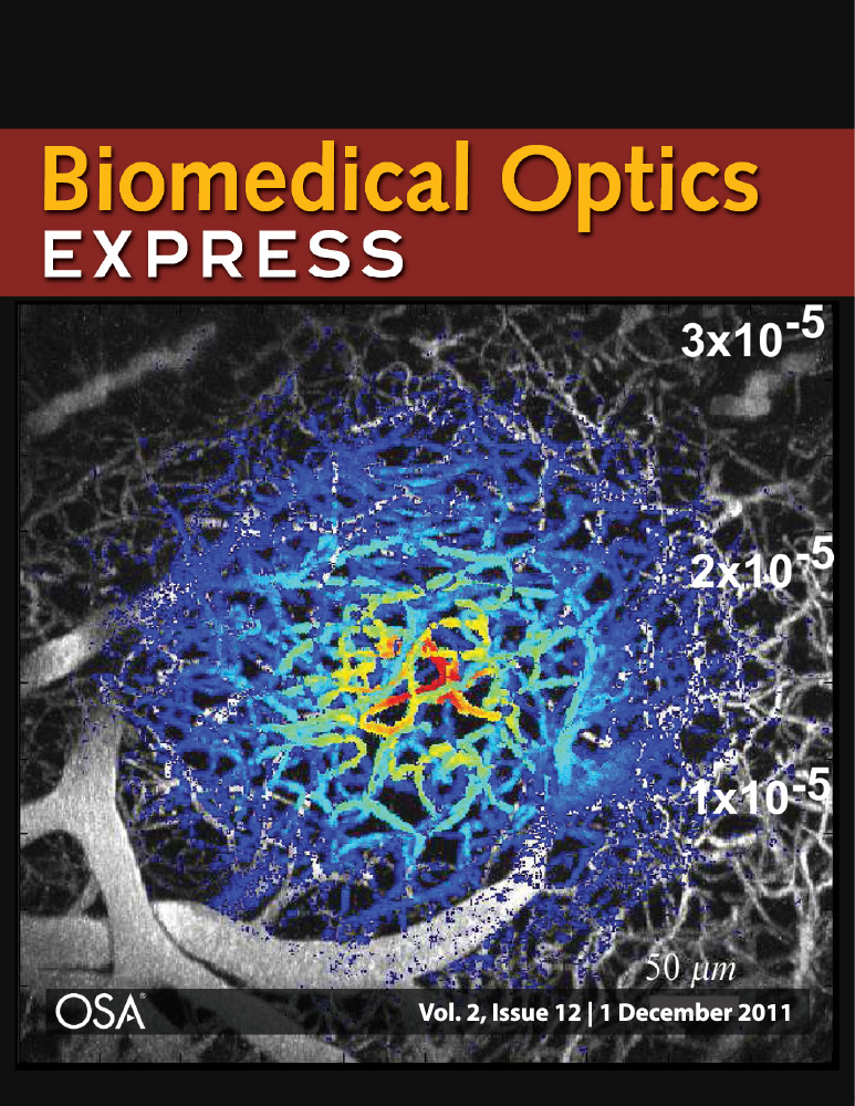 Depth dependence of vascular fluorescence imaging | Functional Optical Imaging Laboratory