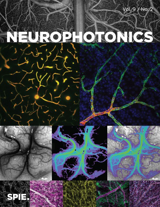 Continuous blood flow visualization with laser speckle contrast imaging ...